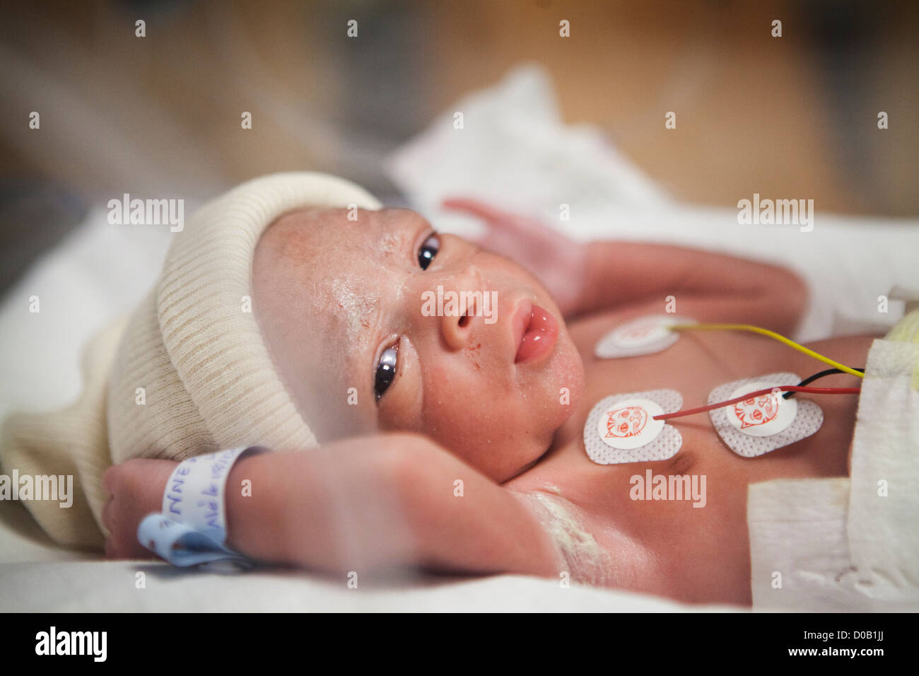 Ecg boy electrodes hi-res stock photography and images - Alamy