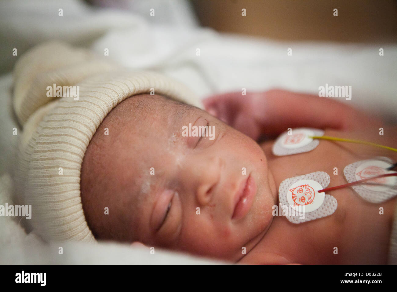 Ecg boy electrodes hi-res stock photography and images - Alamy