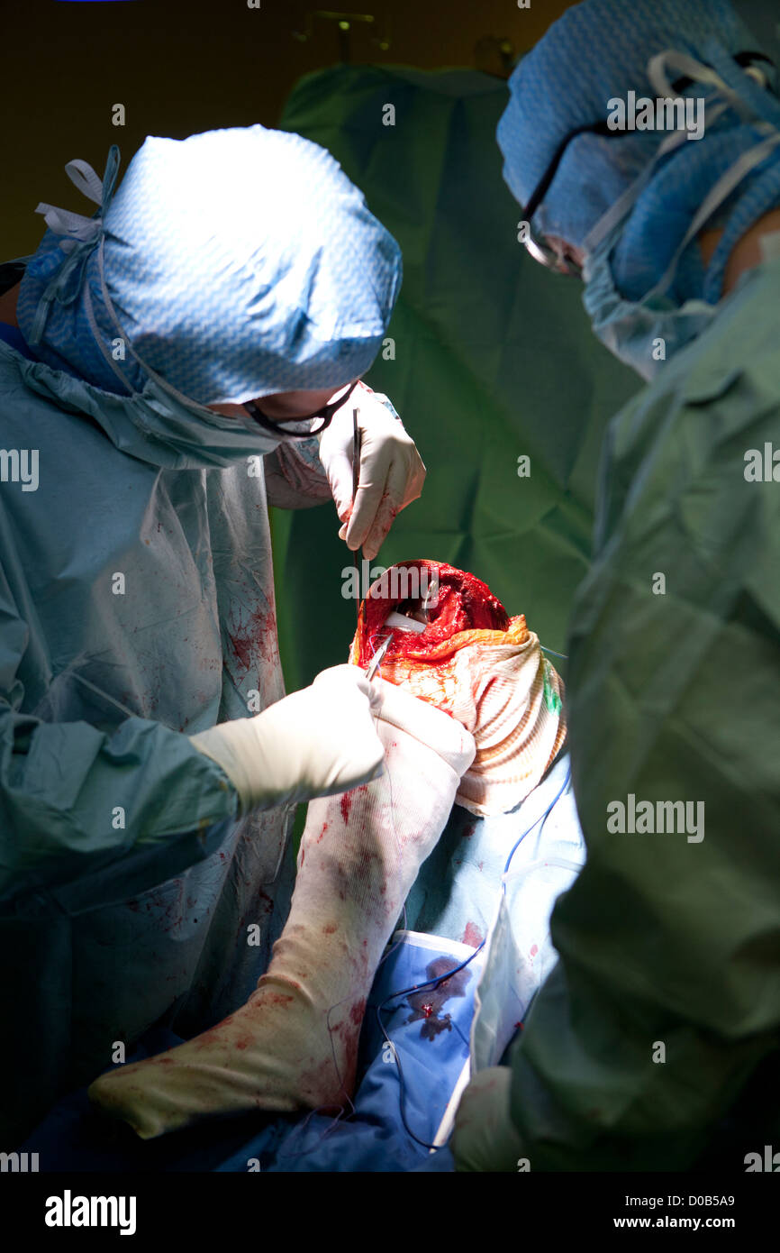 Total knee surgery hi-res stock photography and images - Alamy