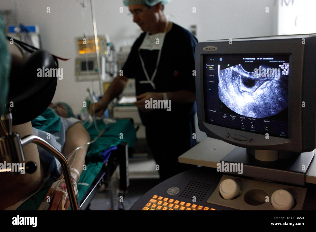 Transvaginal ultrasound hi-res stock photography and images - Alamy