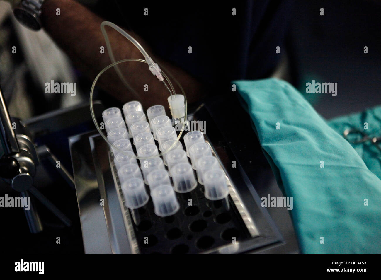 Follicular puncture hi-res stock photography and images - Alamy