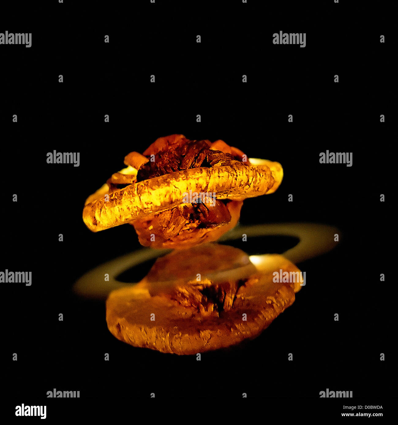 Gallstone disease hi-res stock photography and images - Alamy