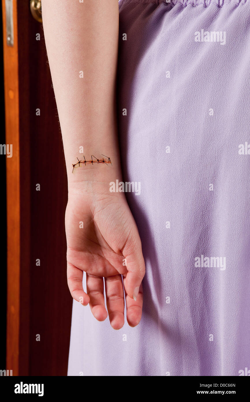 Wrist scar hi-res stock photography and images - Alamy
