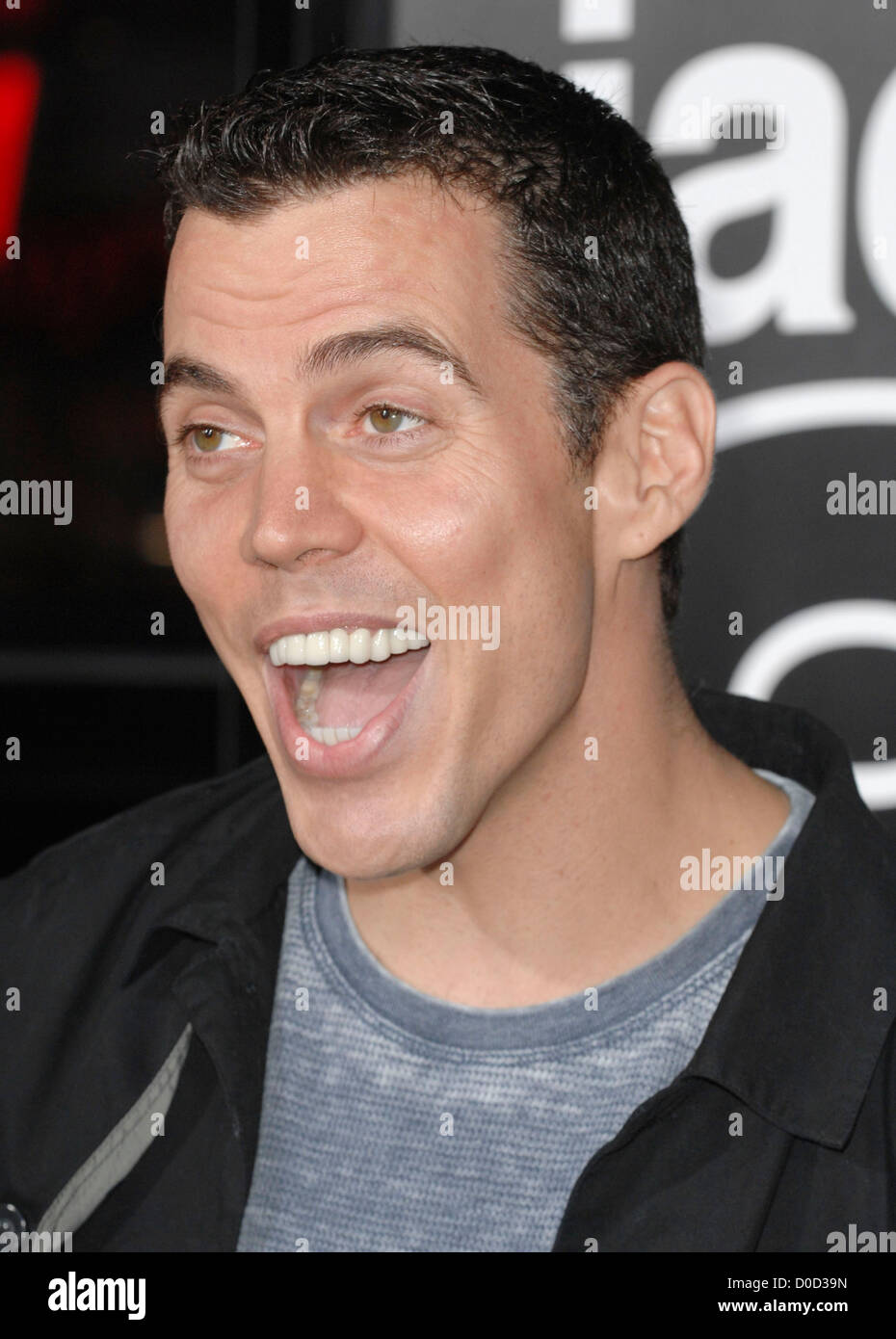 Steve O Before And After Teeth