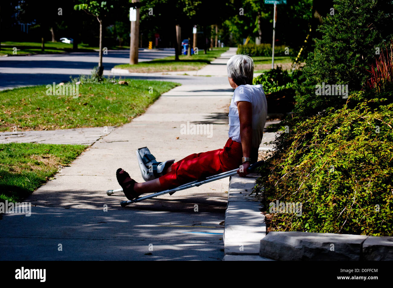 A woman with a cast on an injured foot rests during a walk Stock Photo ...