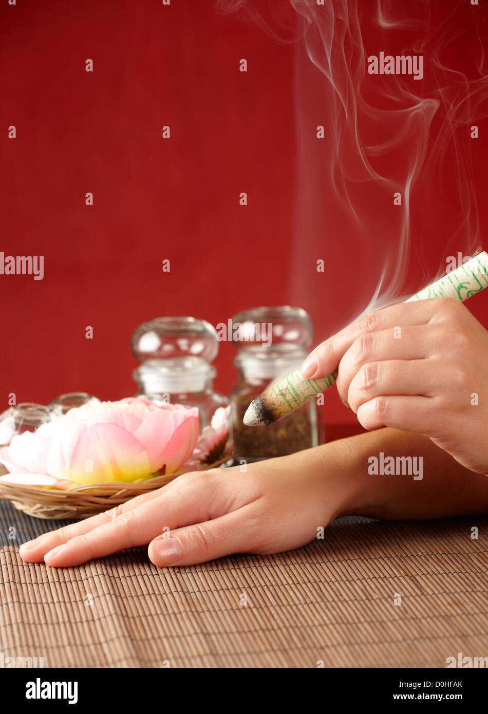 TCM Traditional Chinese Medicine. Hand applying moxa stick therapy ...