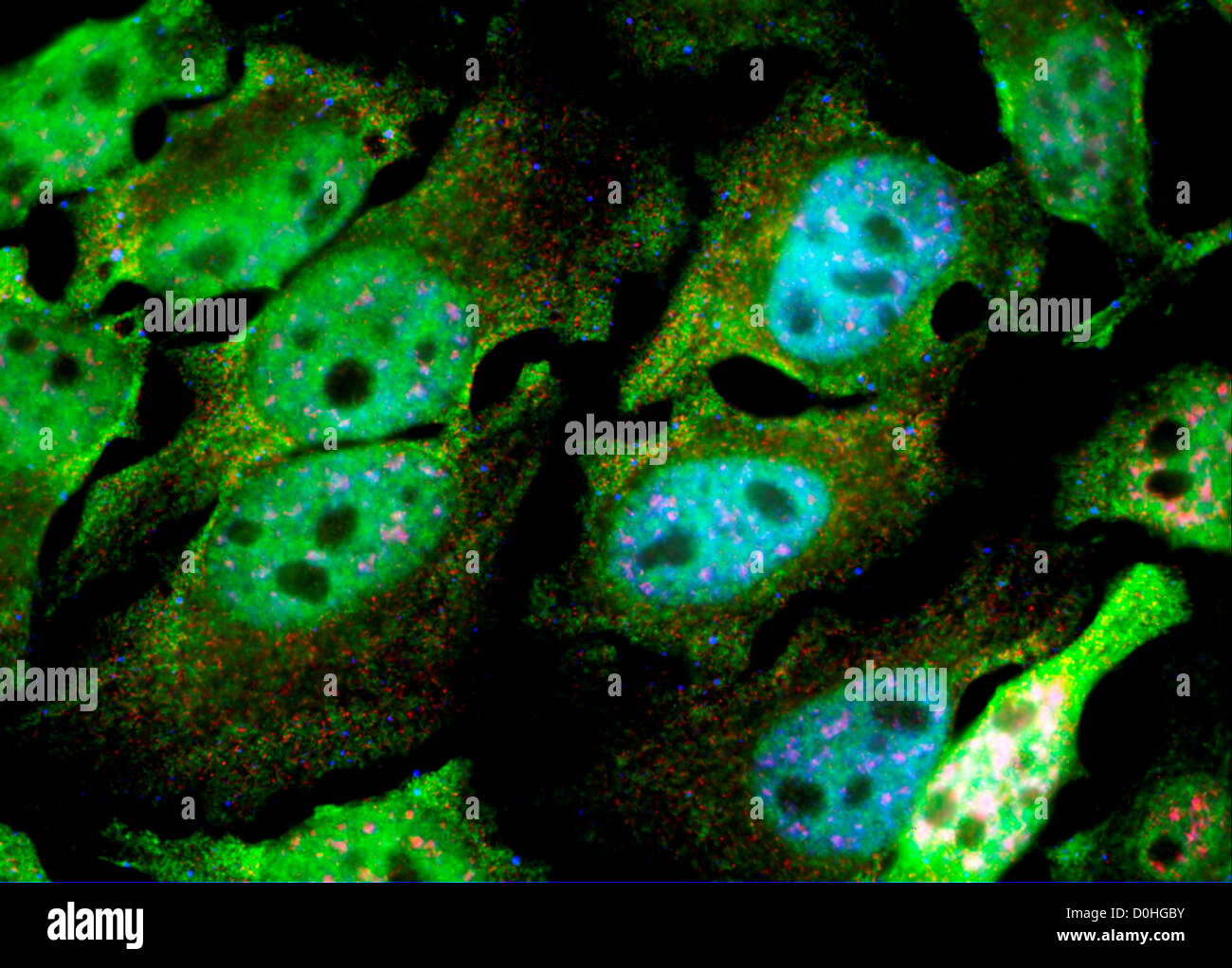 Immortal Cells: HeLa Cells, Microscopic View Stock Photo - Alamy
