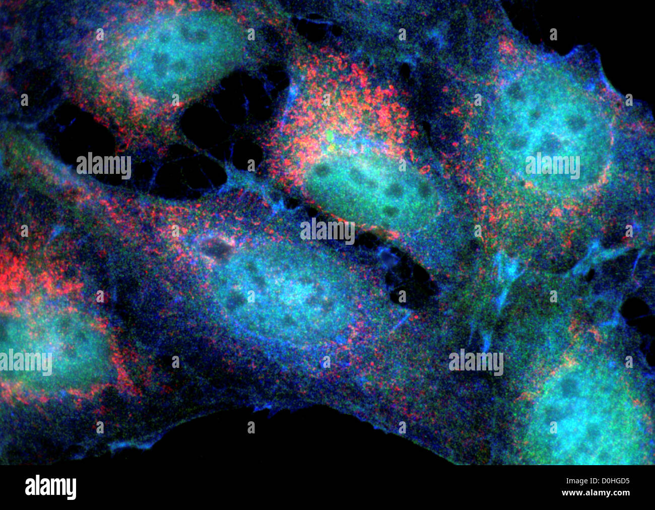 Oxygen-Starved Cancer Cells, Microscopic View Stock Photo - Alamy