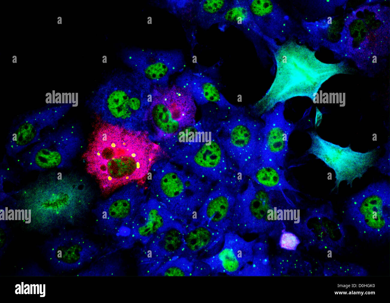 Bloated Red Cells with Mutant Protein, Microscopic View Stock Photo - Alamy