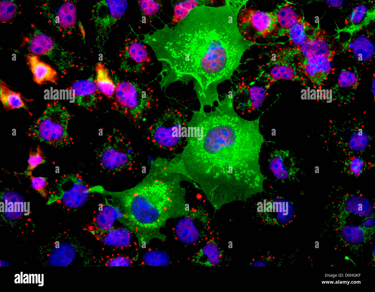 Cancer Cells Adapting to Starvation, Microscopic View Stock Photo - Alamy