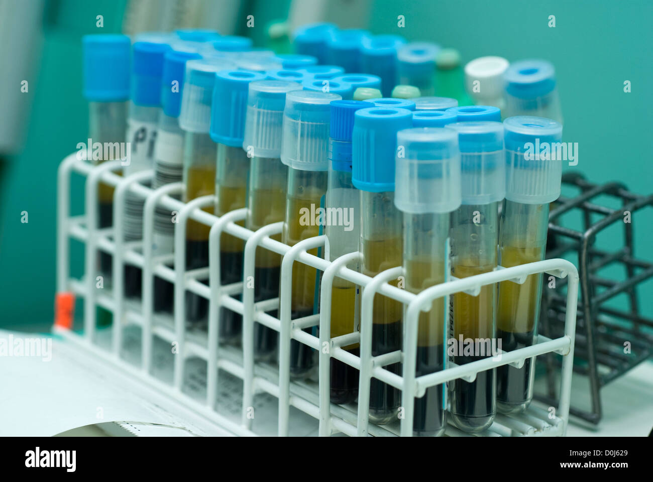 Blood sample barcode hi-res stock photography and images - Alamy