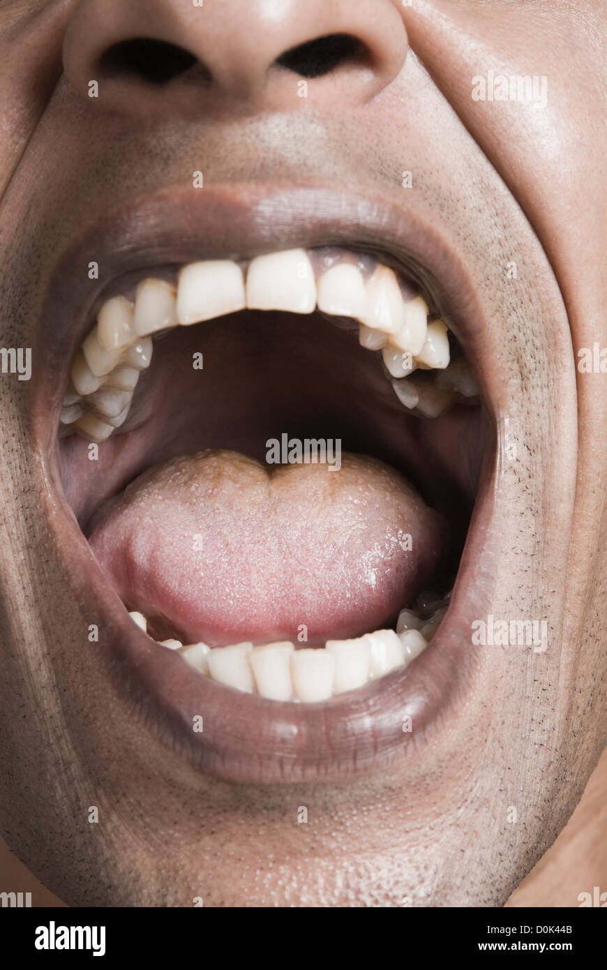 Human mouth open wide teeth hi-res stock photography and images - Alamy