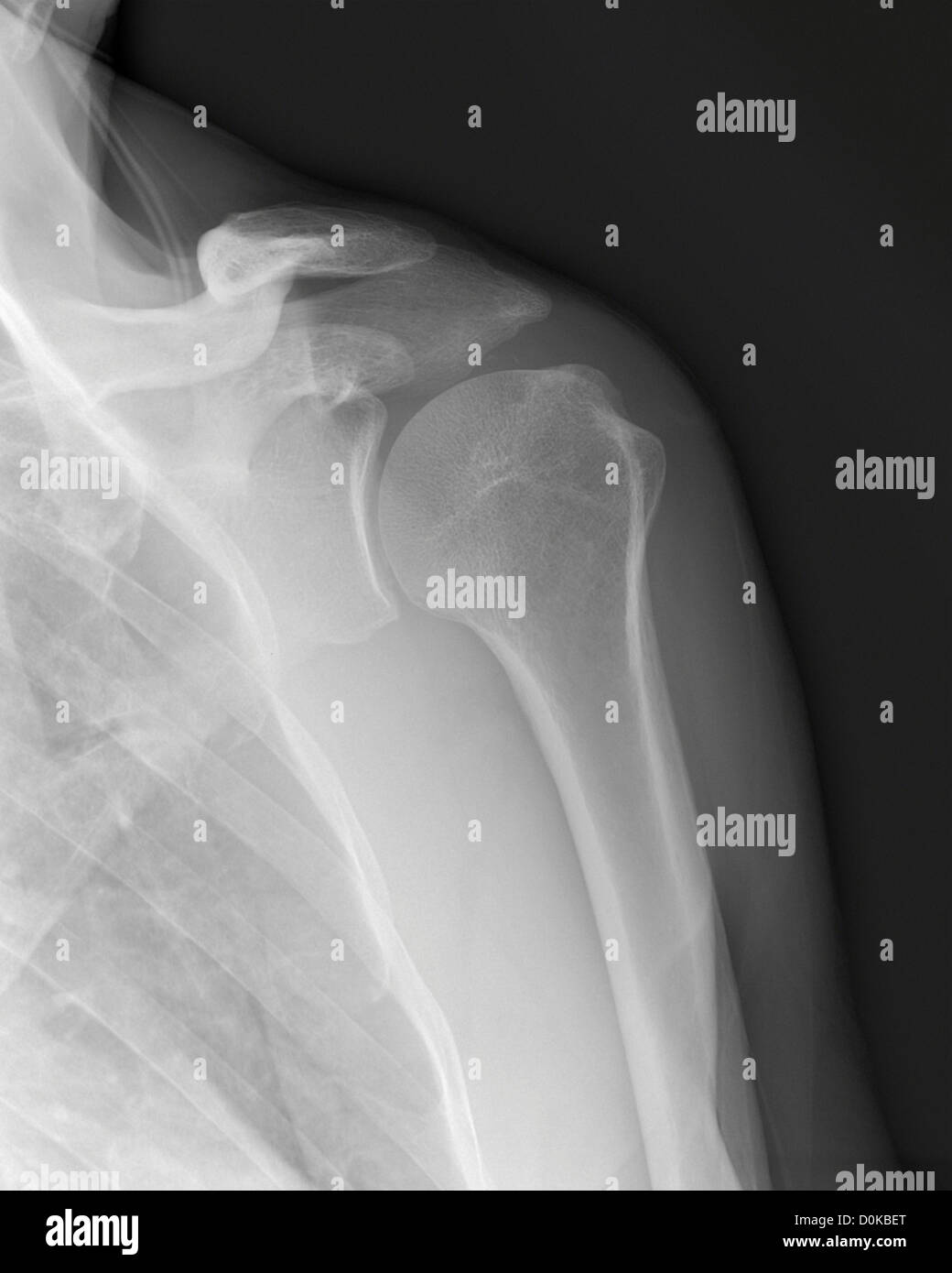 X rays of body parts hi-res stock photography and images - Alamy