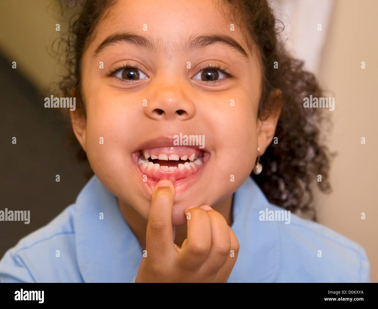 Girl with New Teeth Stock Photo - Alamy