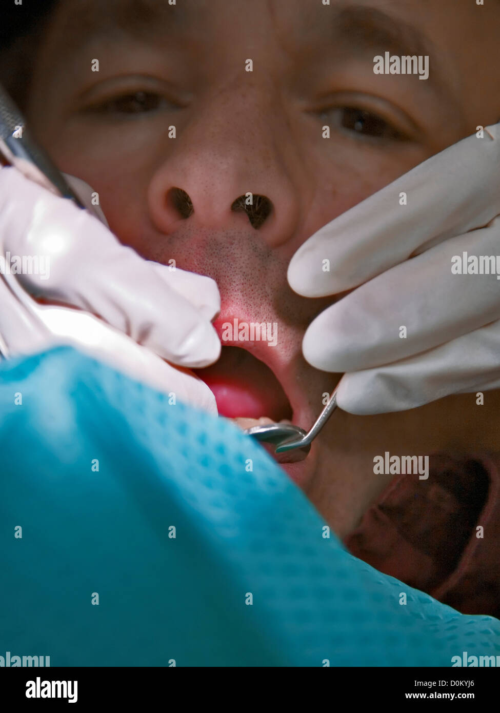 Man Having Teeth Cleaned Stock Photo - Alamy