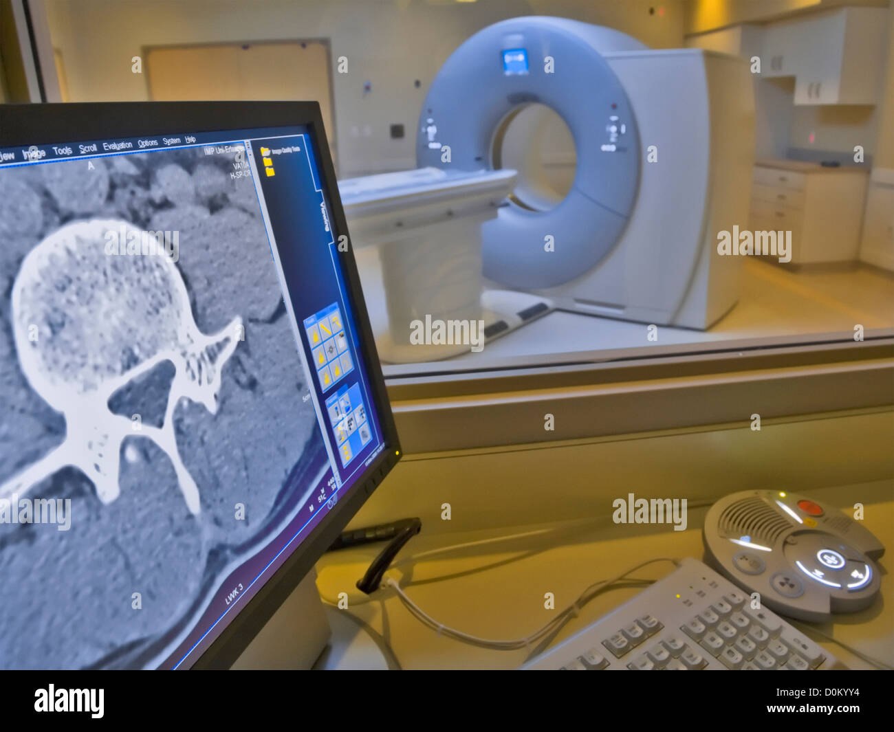 Definition as ct scanner hi-res stock photography and images - Alamy