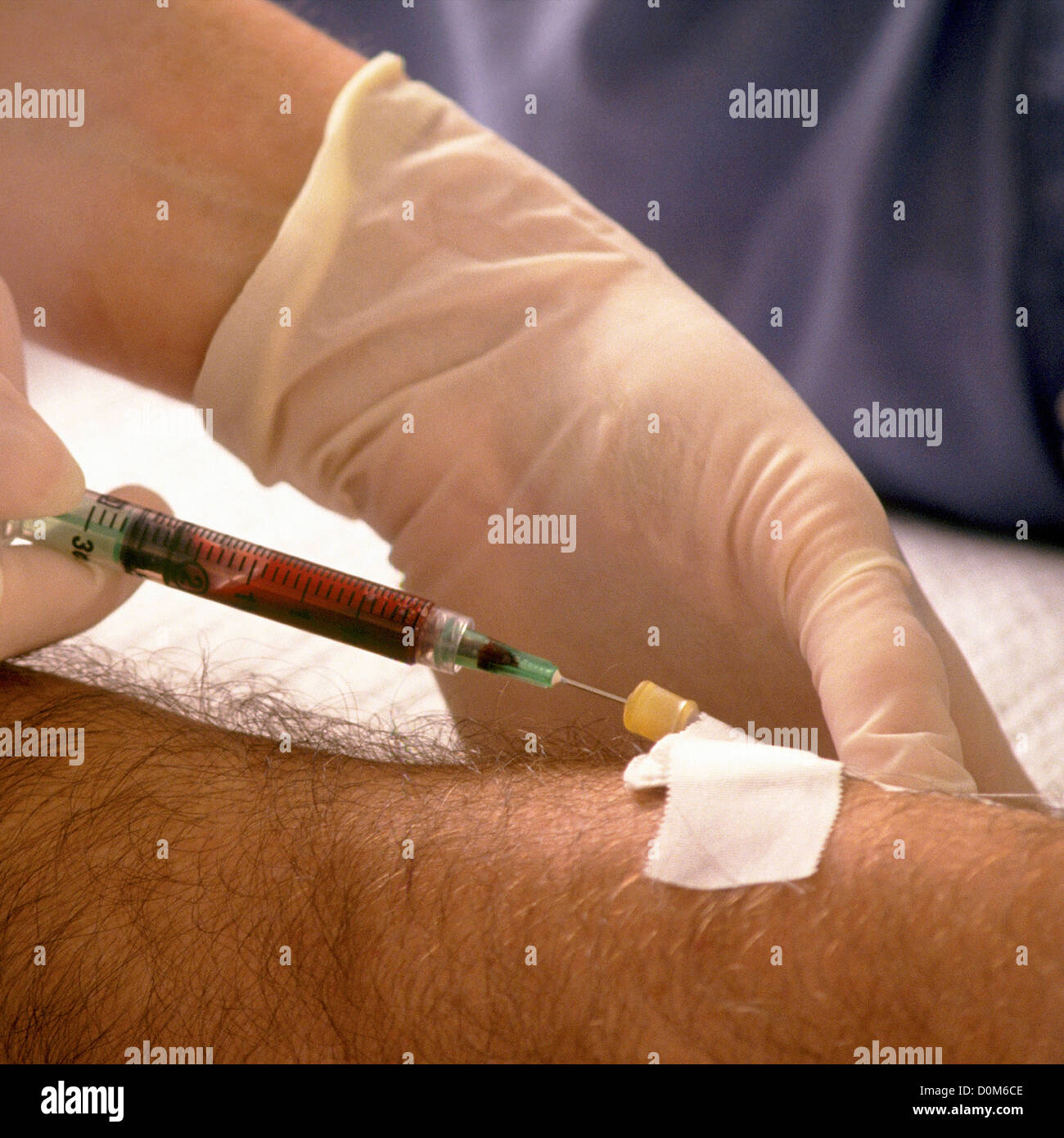 Close up syringe drawing blood hi-res stock photography and images - Alamy