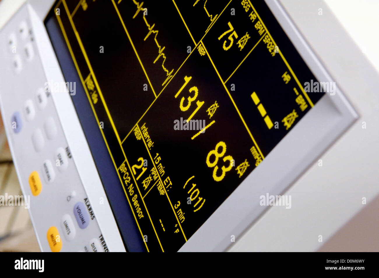 Close-up of Vital Statistics Monitor Stock Photo - Alamy