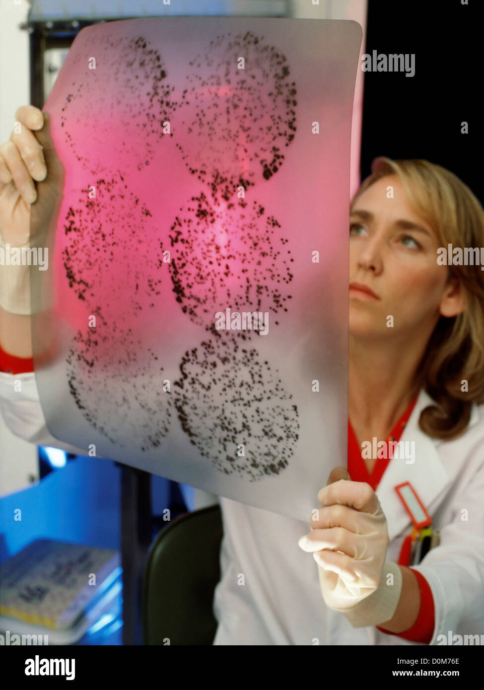 Autoradiograph hi-res stock photography and images - Alamy