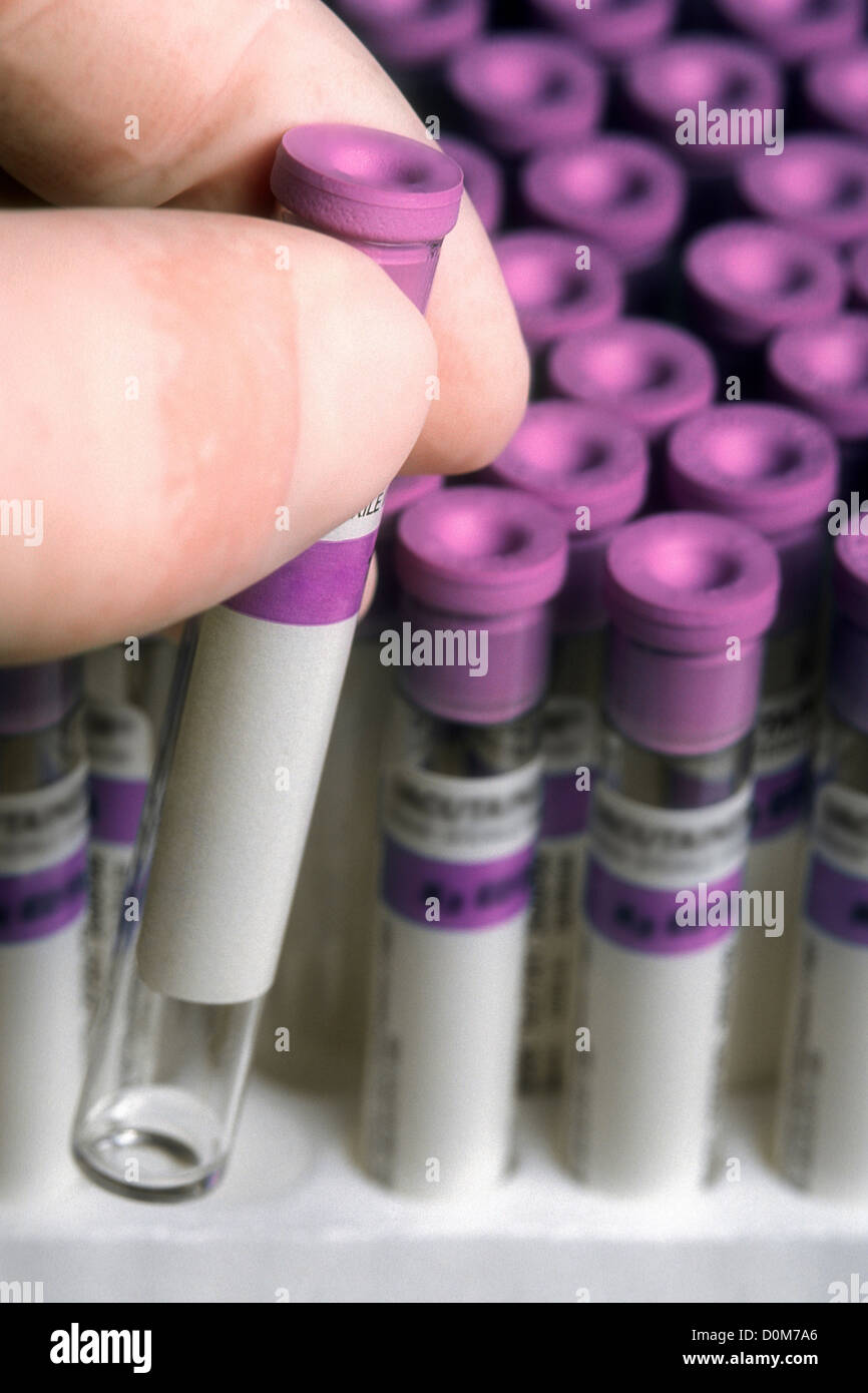 Latex containers hi-res stock photography and images - Alamy