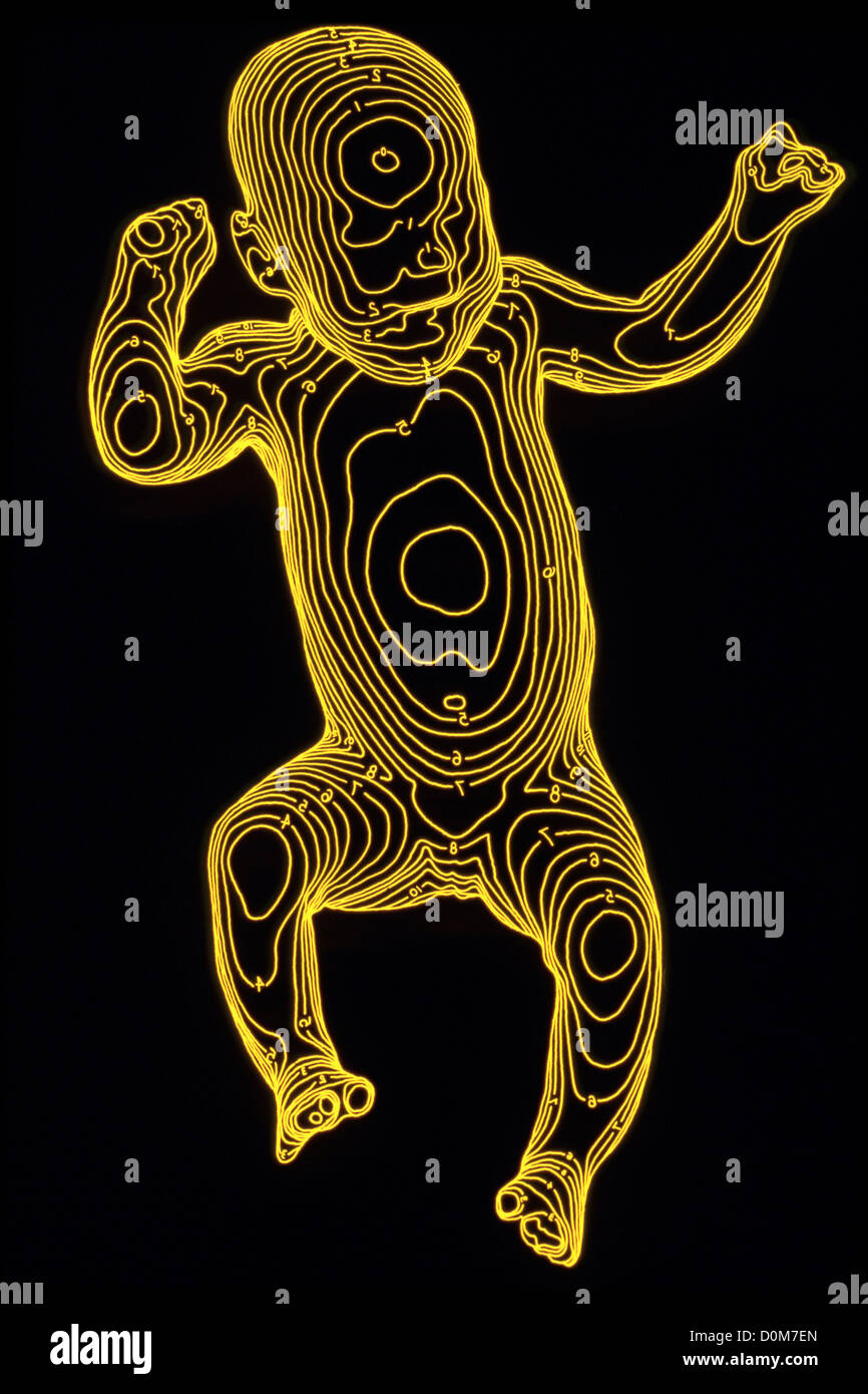 Body contour map hi-res stock photography and images - Alamy