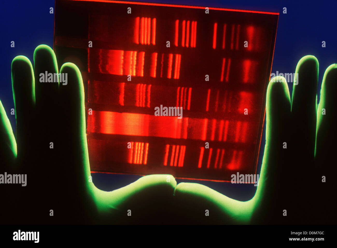 Dna bands hi-res stock photography and images - Alamy