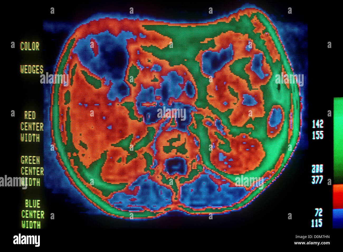 Human stomach mri hi-res stock photography and images - Alamy