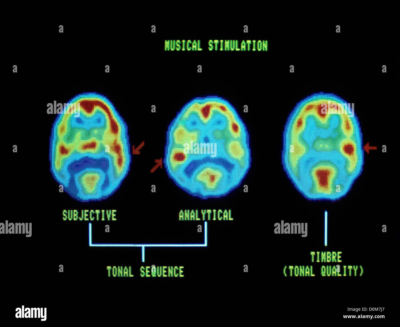 Auditory stimulation hi-res stock photography and images - Alamy Auditory stimulation hi-res stock photography and images - Alamy