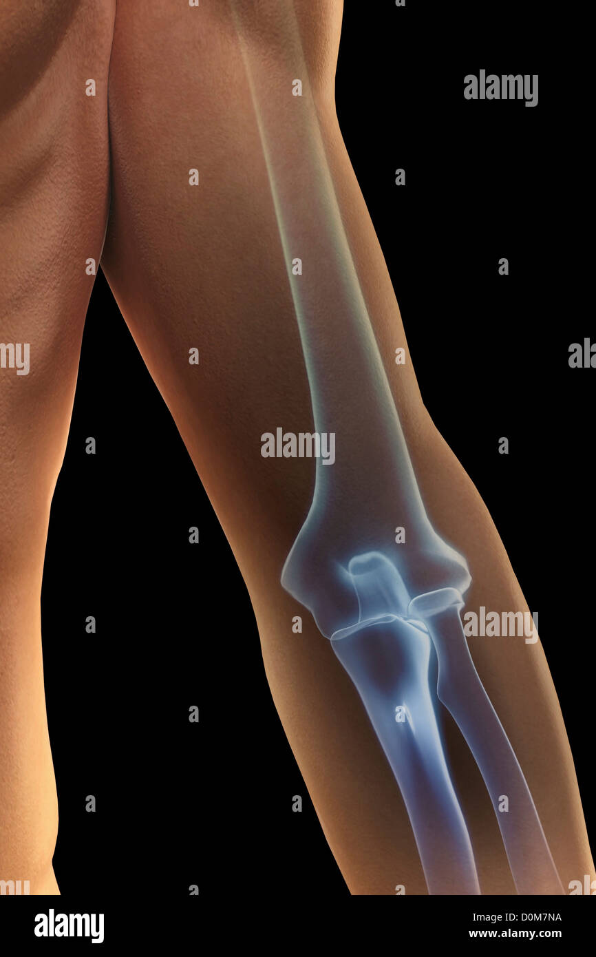 Stylized front view of the bones of the left elbow Stock Photo - Alamy