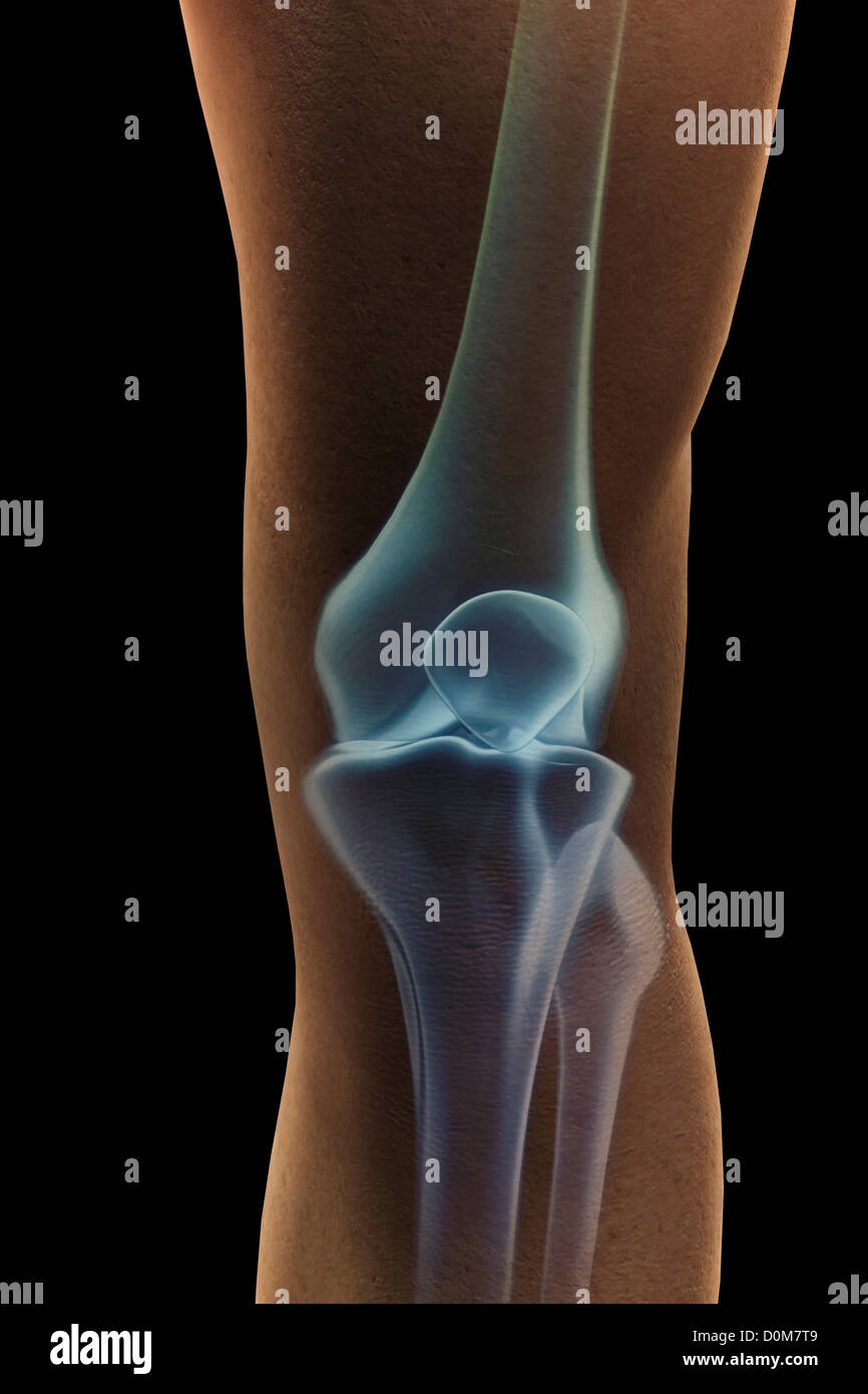 Stylized front view of the bones of the knee joint within the skin ...