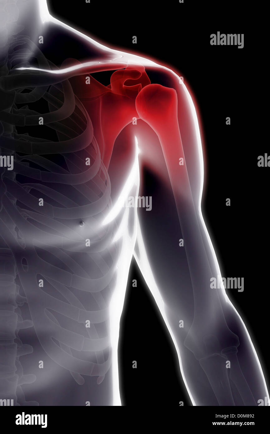 Front view of stylized bones of the shoulder joint. The glenohumeral ...