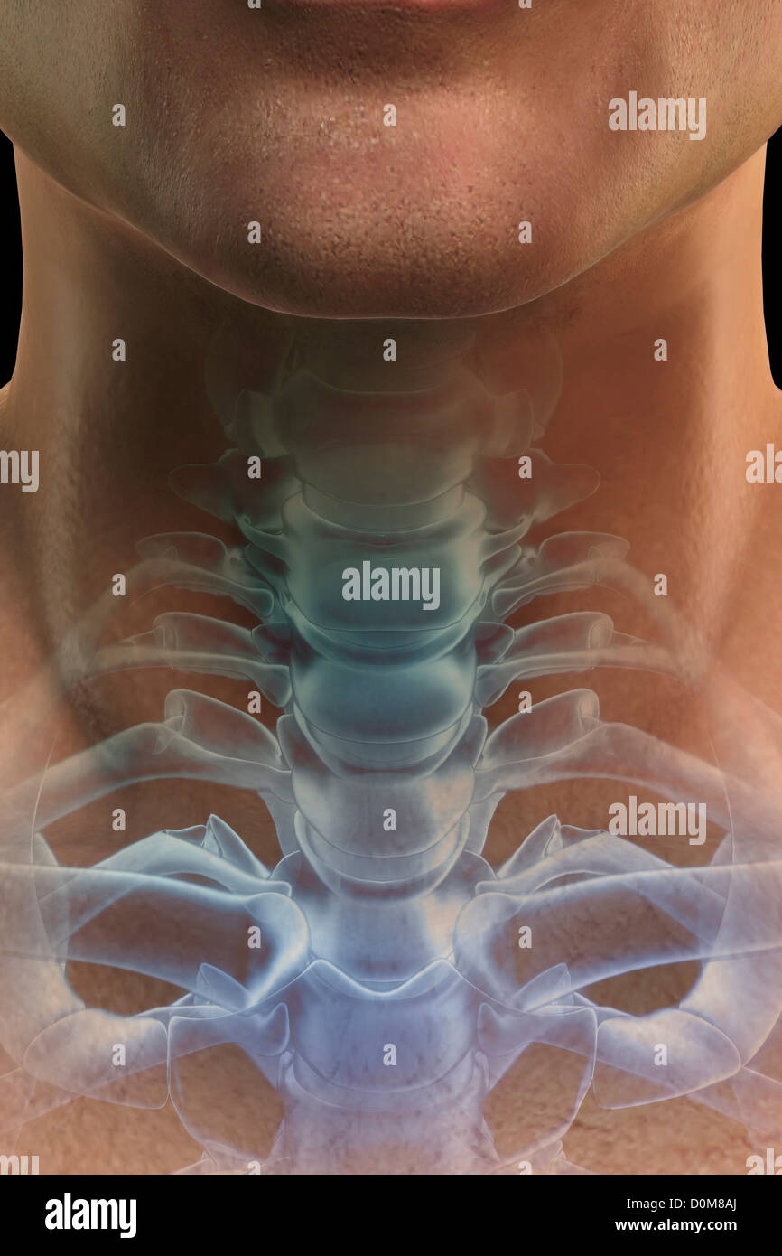 Front view of stylized bones of the cervical spine and sternoclavicular ...