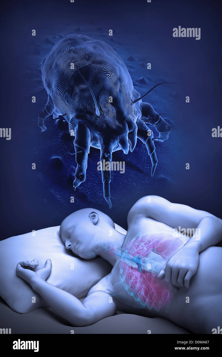 Dermatophagoides hi-res stock photography and images - Alamy