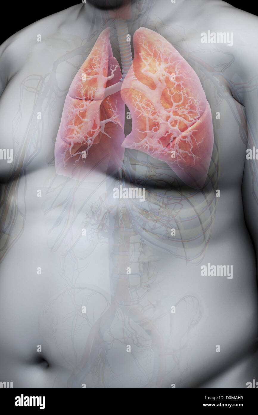Human lungs layered over an overweight man's body to show the ...