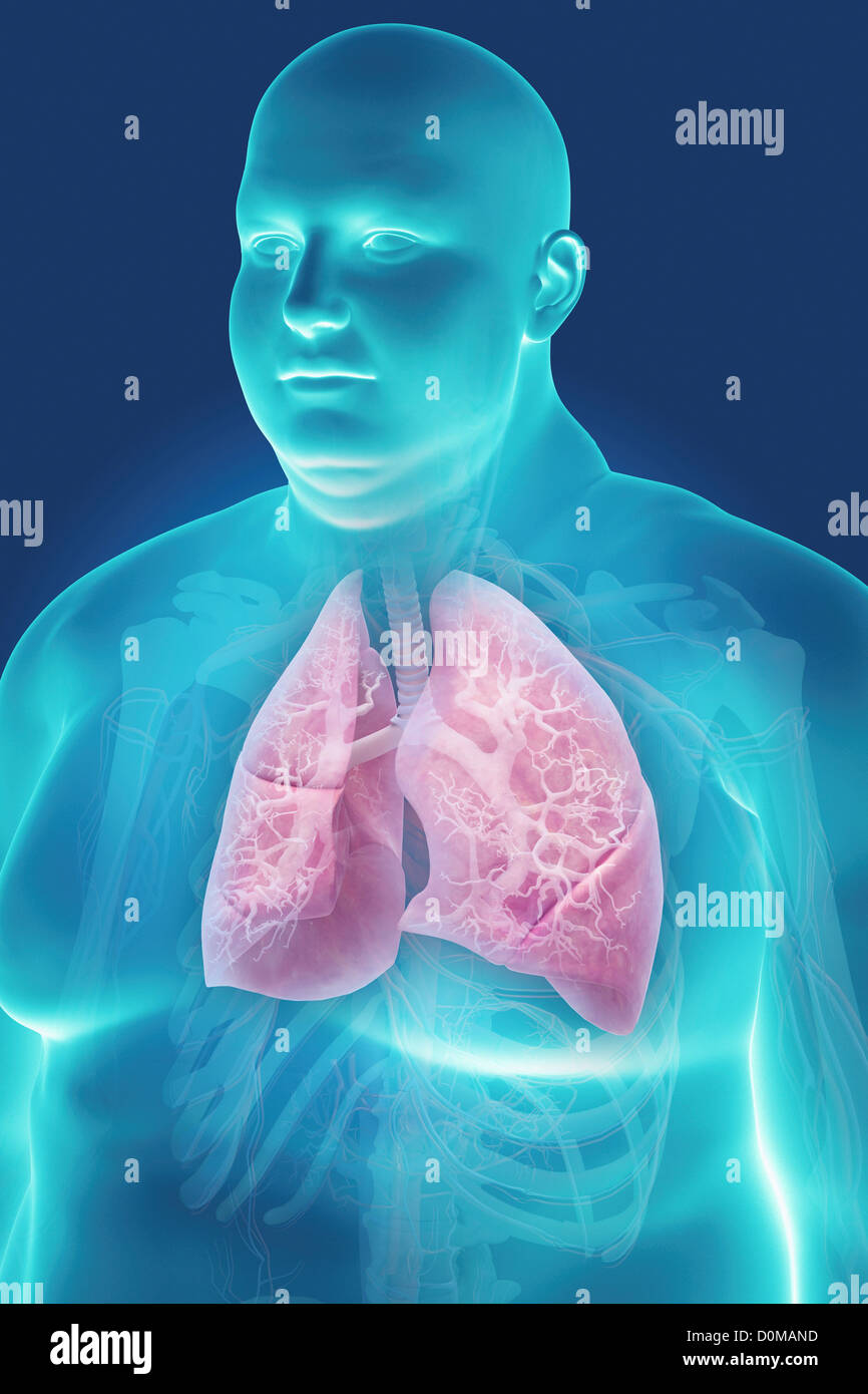 Human lungs layered over an overweight man's body to show the ...
