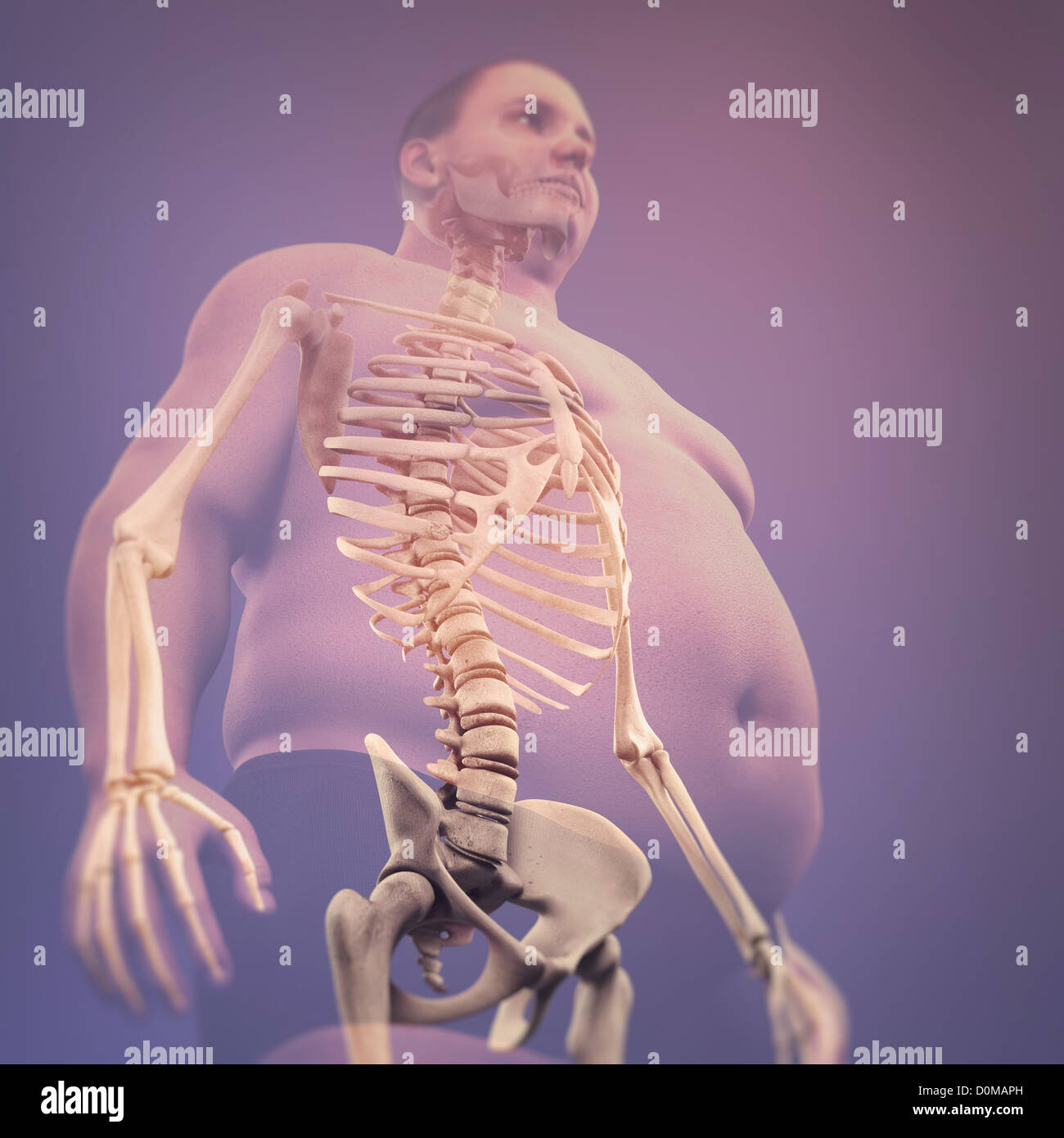 Human skeleton layered over overweight man's back to reveal the impact ...