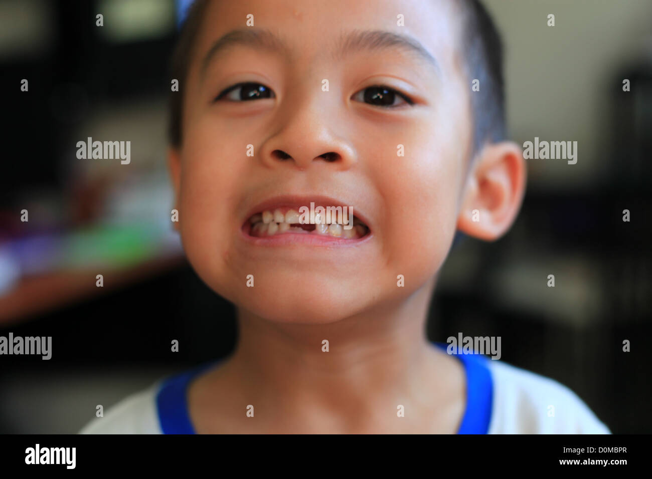 Smiling young boy with missing front teeth hi-res stock photography and ...