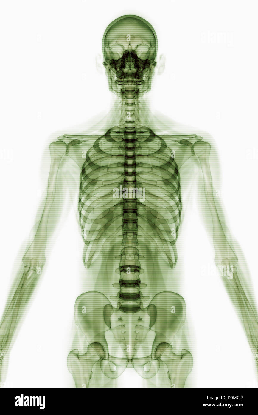 X-Ray image showing the rib cage and pelvis Stock Photo - Alamy