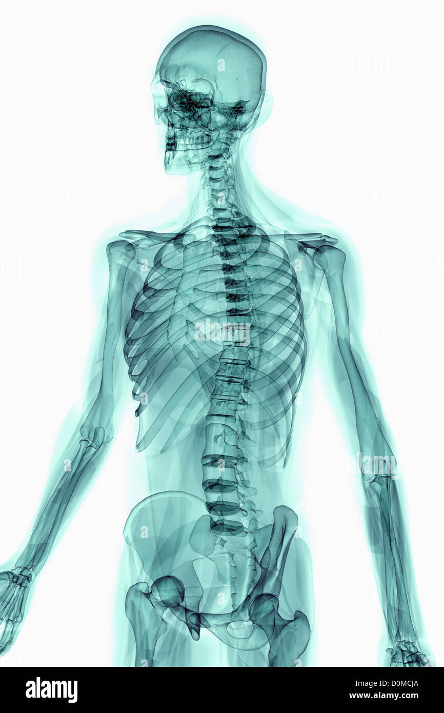 X-Ray image showing the rib cage and pelvis Stock Photo - Alamy