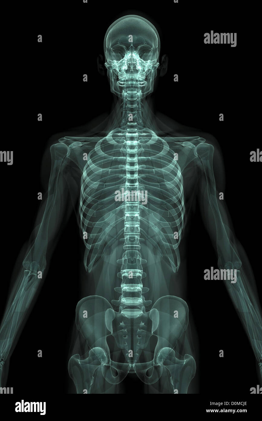 X-Ray image showing the rib cage and pelvis Stock Photo - Alamy
