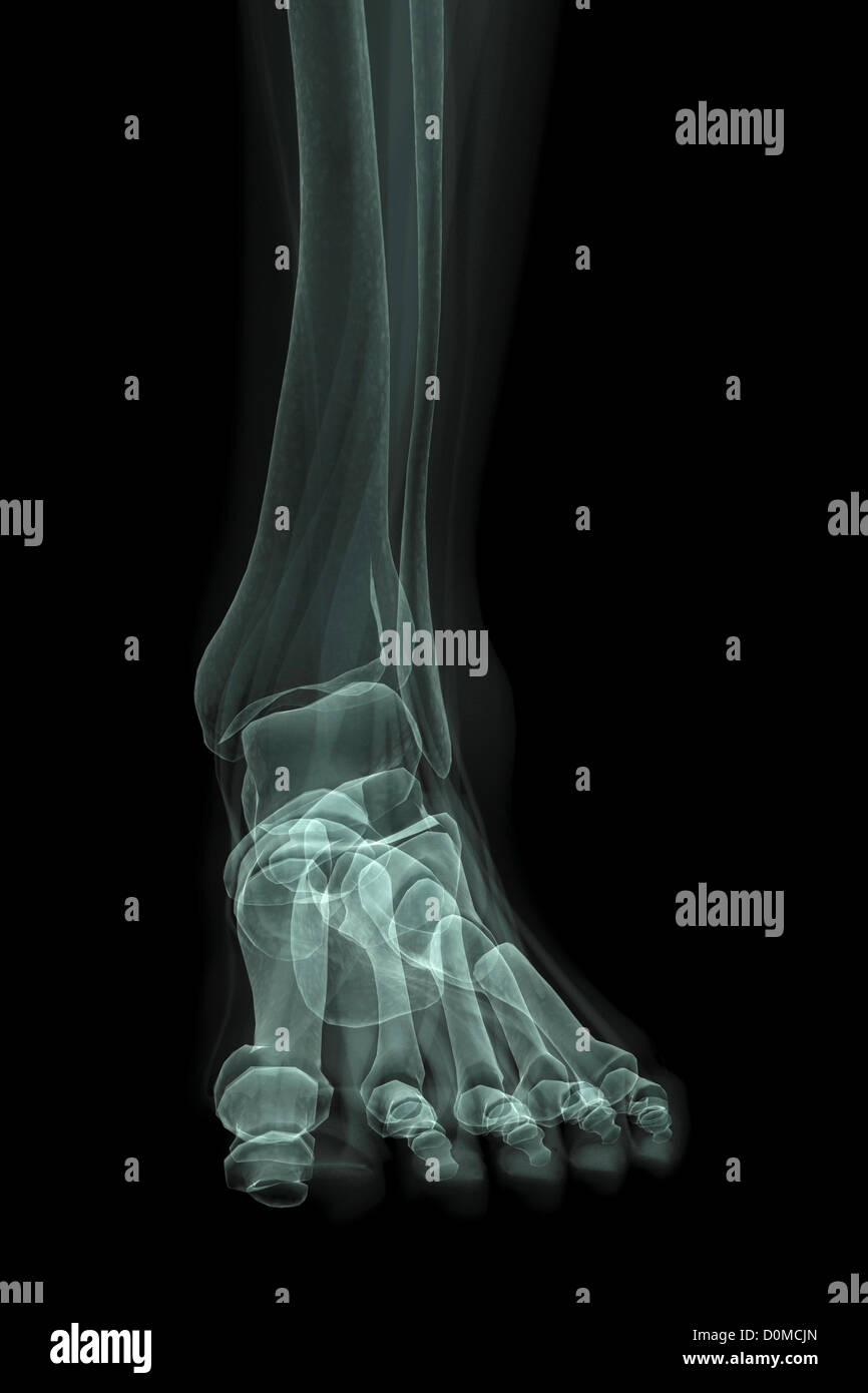 X-ray image showing the human foot Stock Photo - Alamy