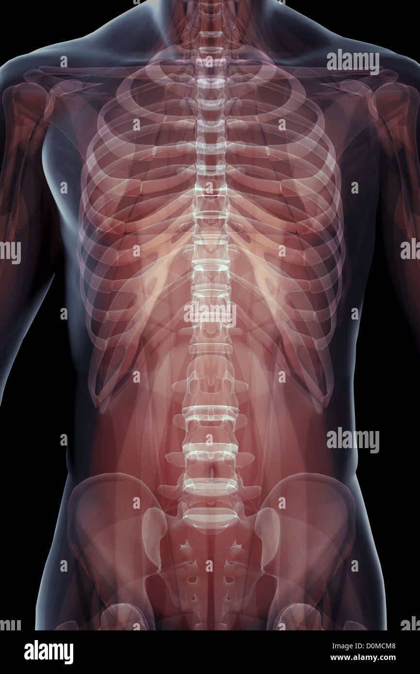 X-ray image showing the skeletal structure of the human thorax, rib ...