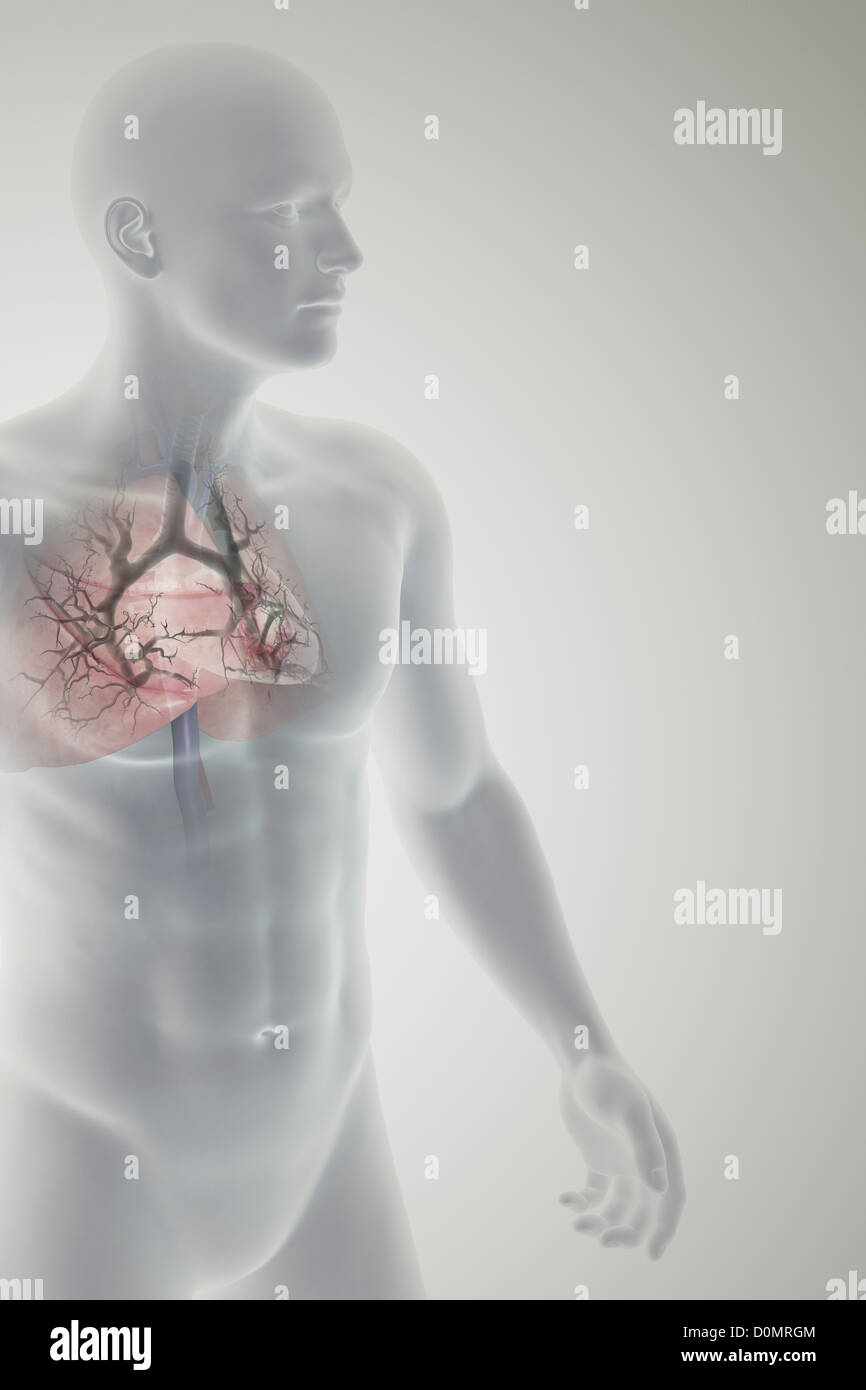 Bronchial Tubes High Resolution Stock Photography and Images - Alamy