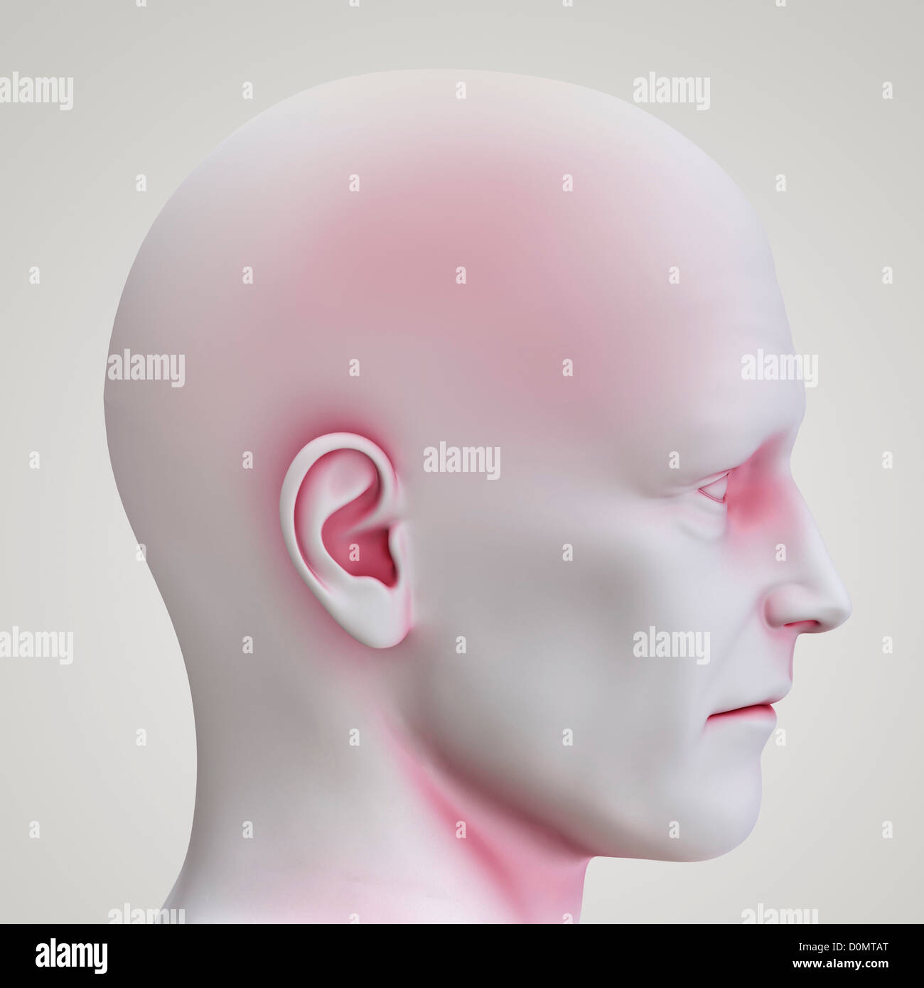 Anatomical model of a human head showing areas affected by a common ...