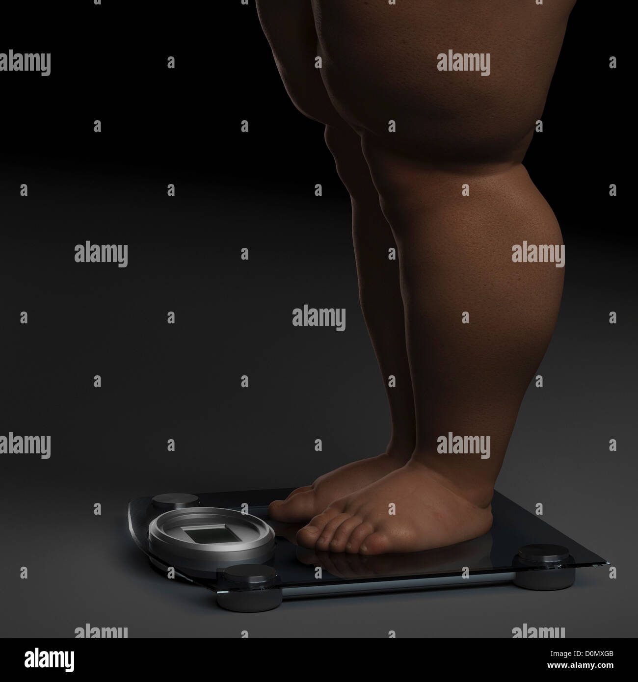 Legs and feet of an anatomical model of an obese person standing on ...