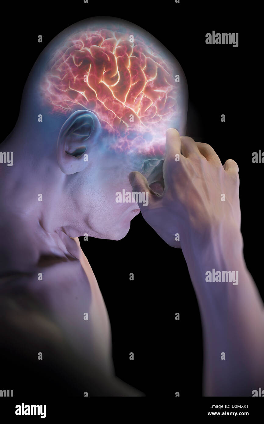 Anatomical model with an illuminated brain representing head pain Stock ...