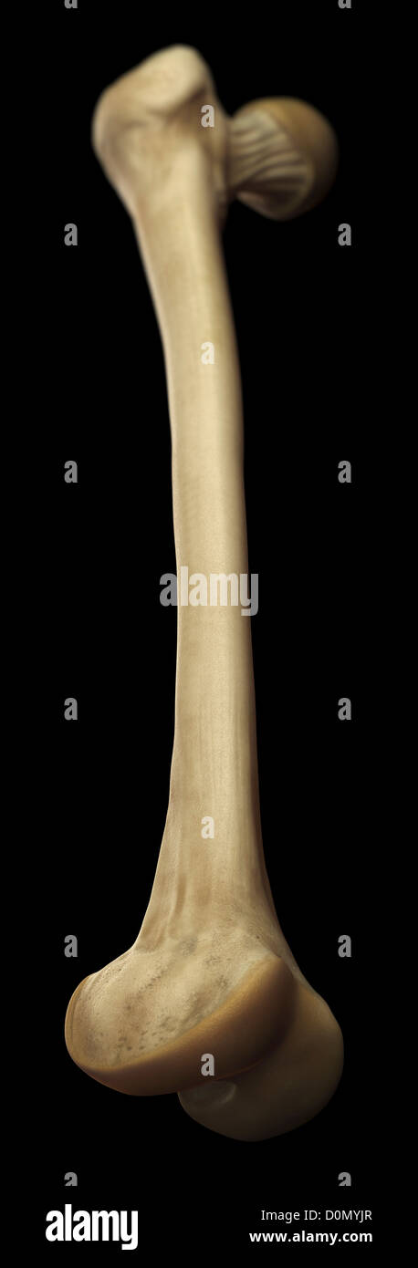 Intercondylar Notch Femur