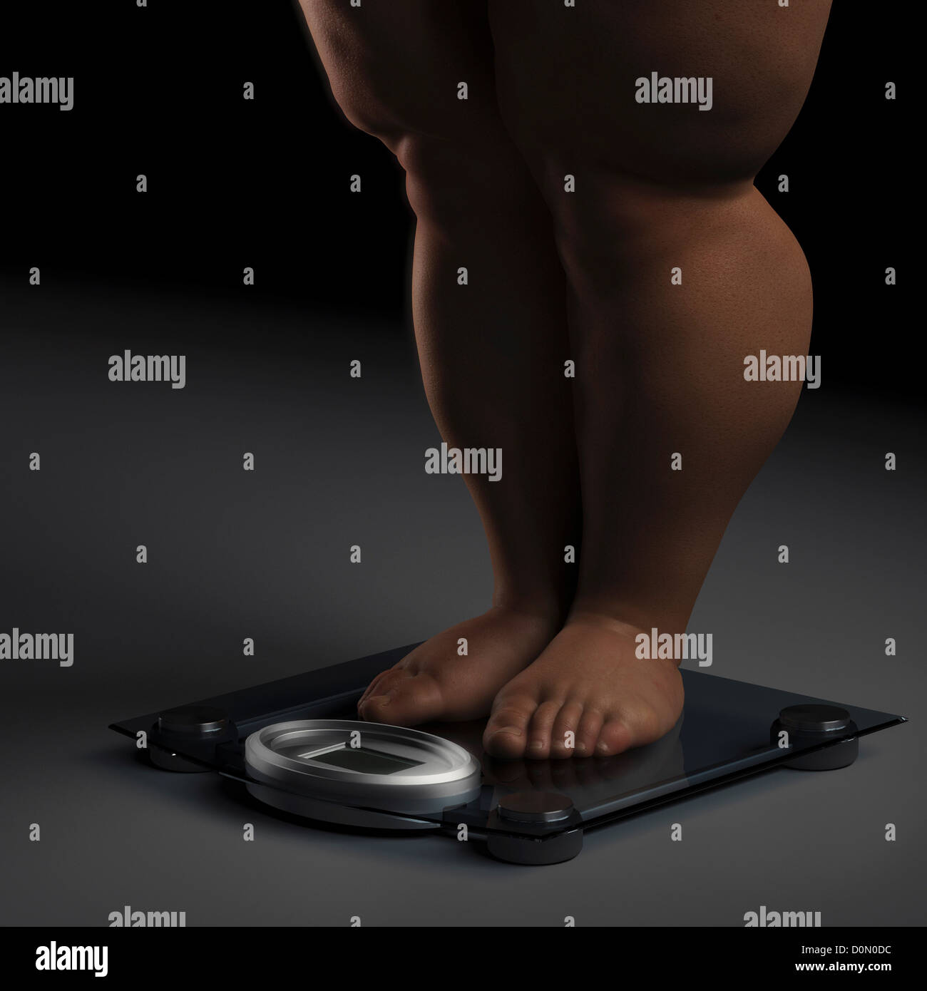 Legs and feet of an anatomical model of an obese person standing on ...