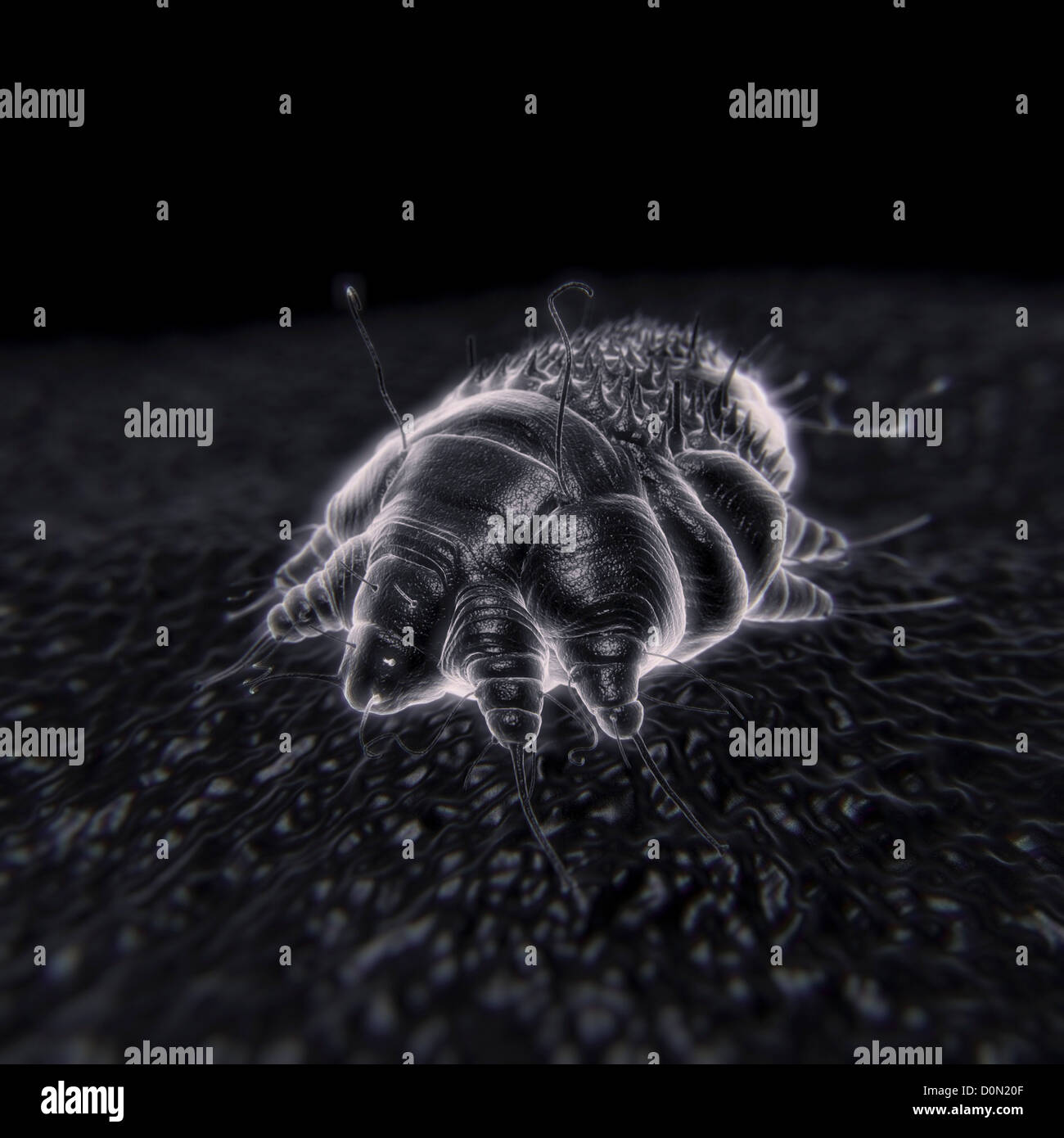 Parasitic Mite Infection Of The Skin Stock Photos & Parasitic Mite ...