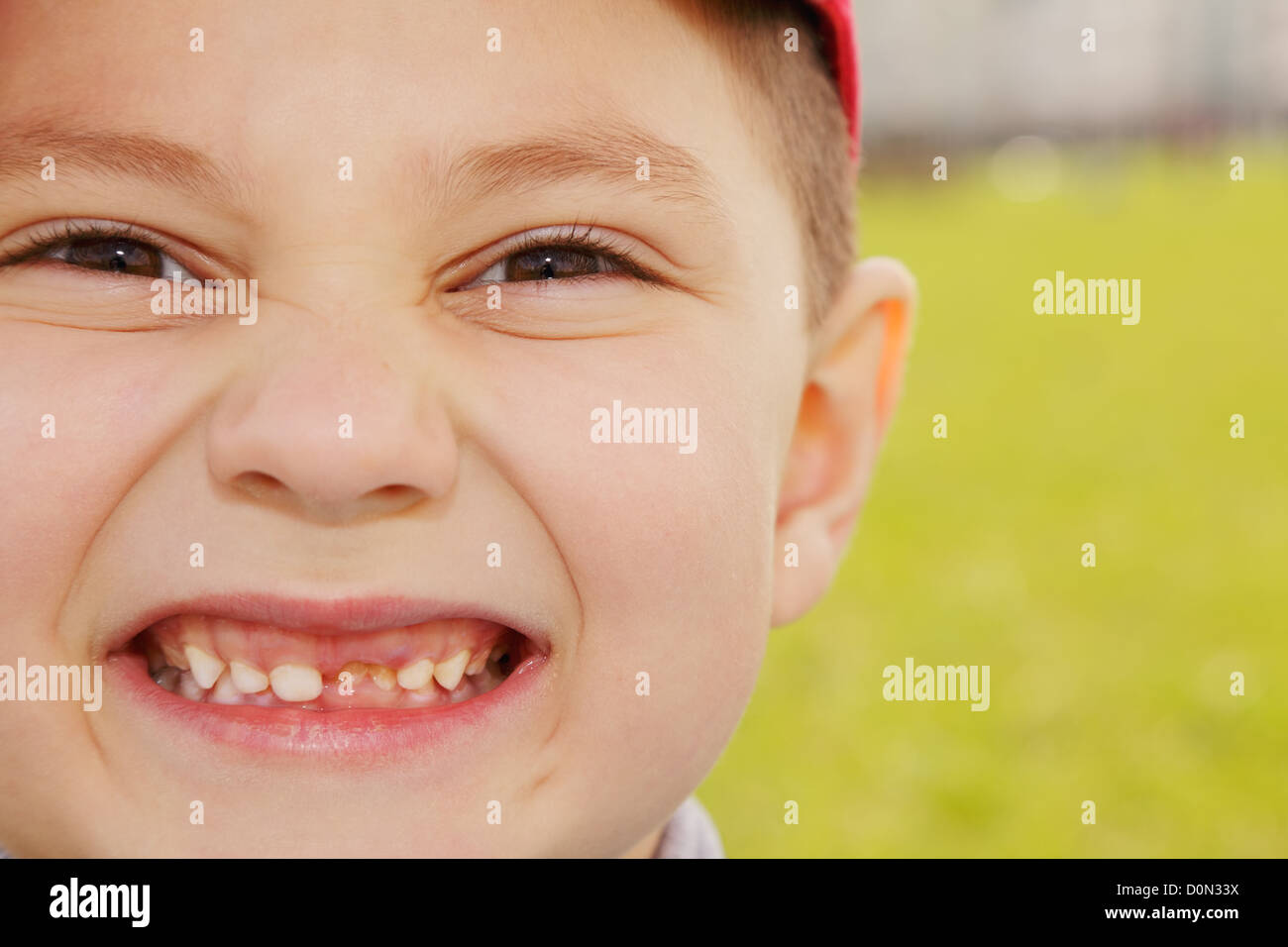 First tooth off Stock Photo - Alamy